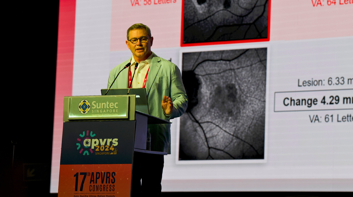 GA Management: A Tale of Innovation and Caution at APVRS 2024 - PIE