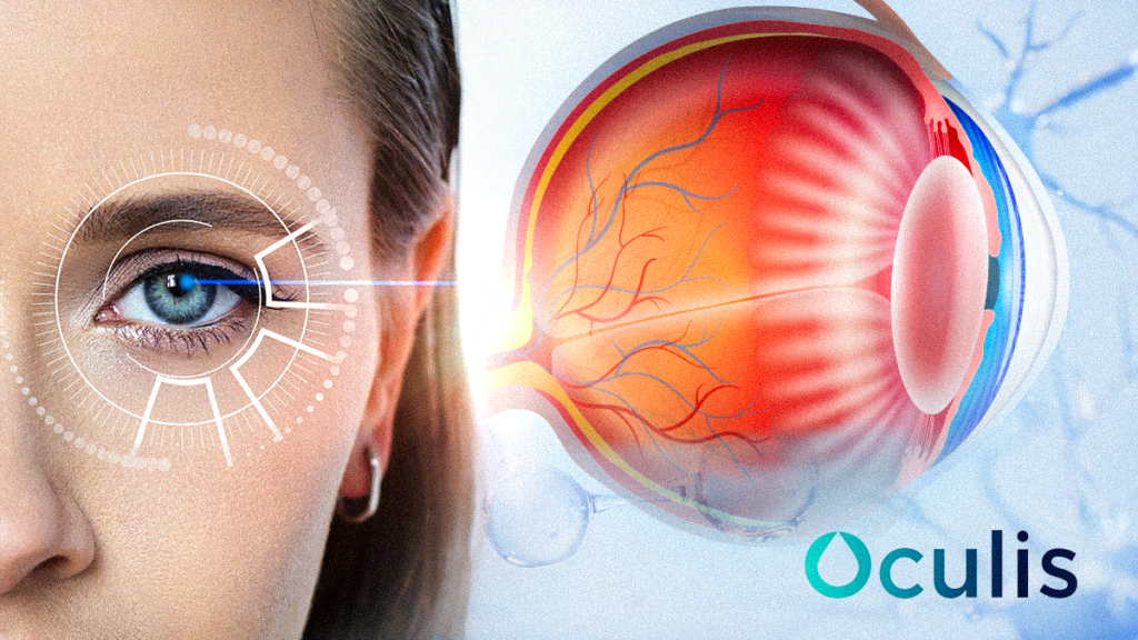 Oculis’ OCS-05 Shows 43% Improvement in Retinal Structure in Acute ...