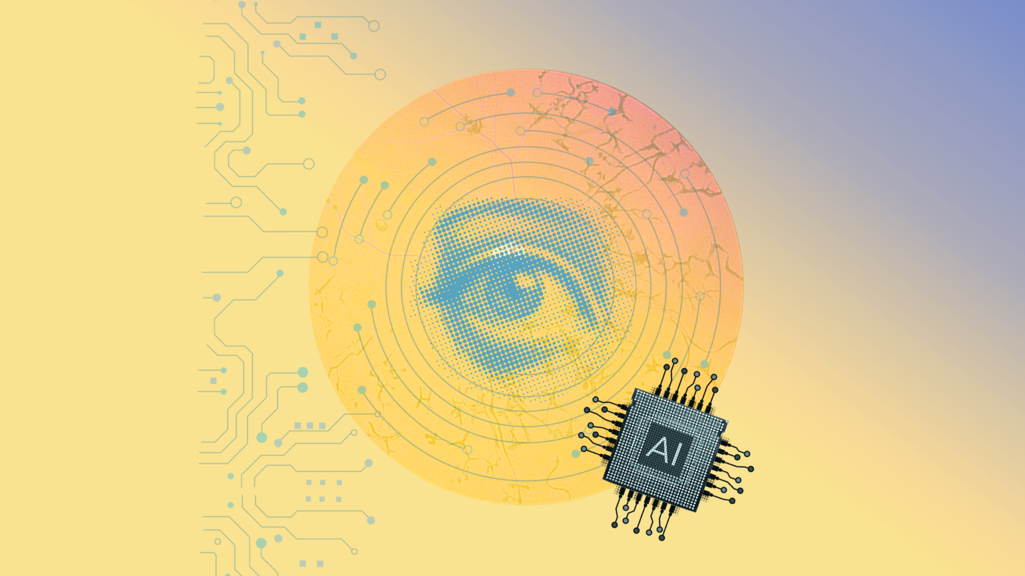 FDA Approves First Fully Autonomous Handheld AI Diabetic Retinopathy ...